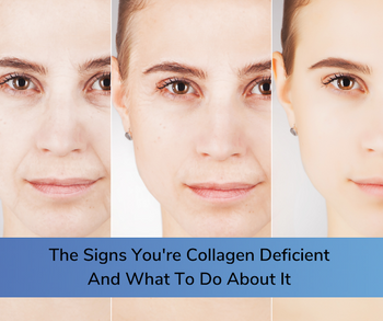 These Major Warning Signs Could Mean You Are Collagen Deficient ...