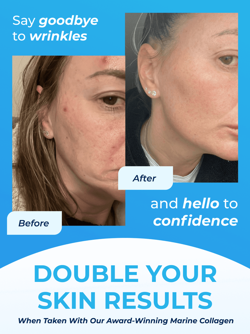 Cherry Skin Booster Bundle Deal | Reverse Life